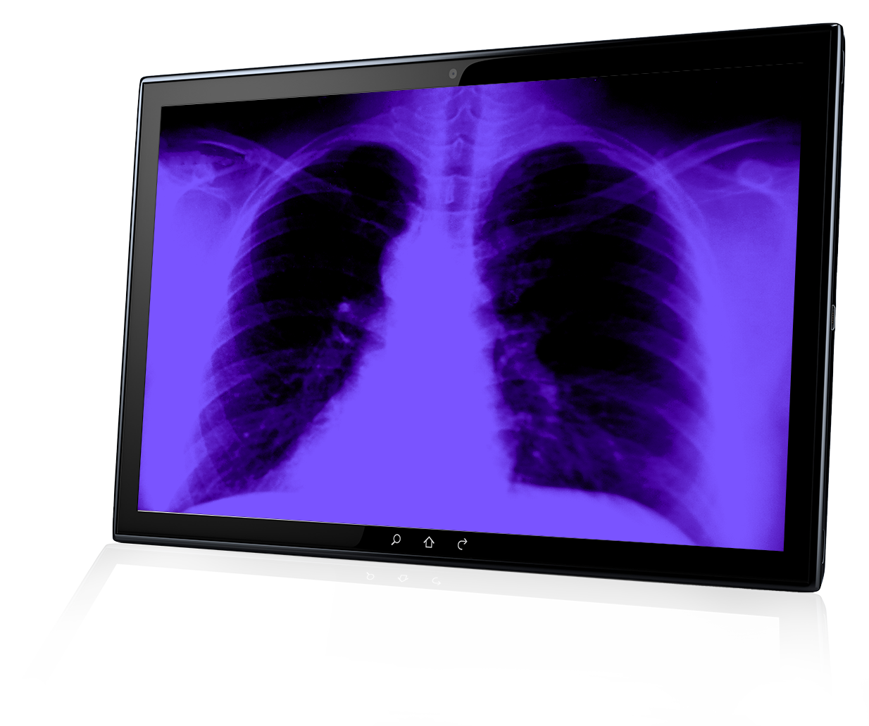 Calyx - Medical Imaging