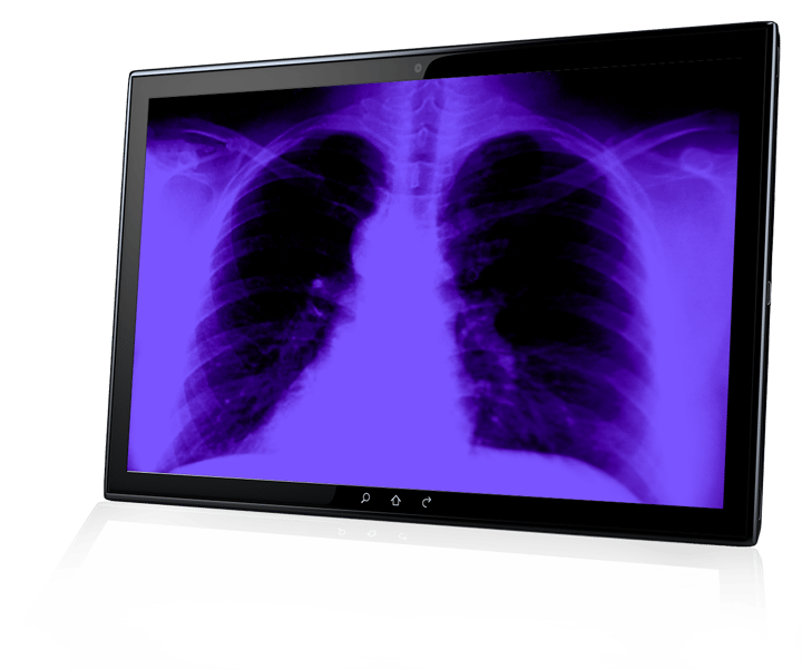 Calyx - Medical Imaging